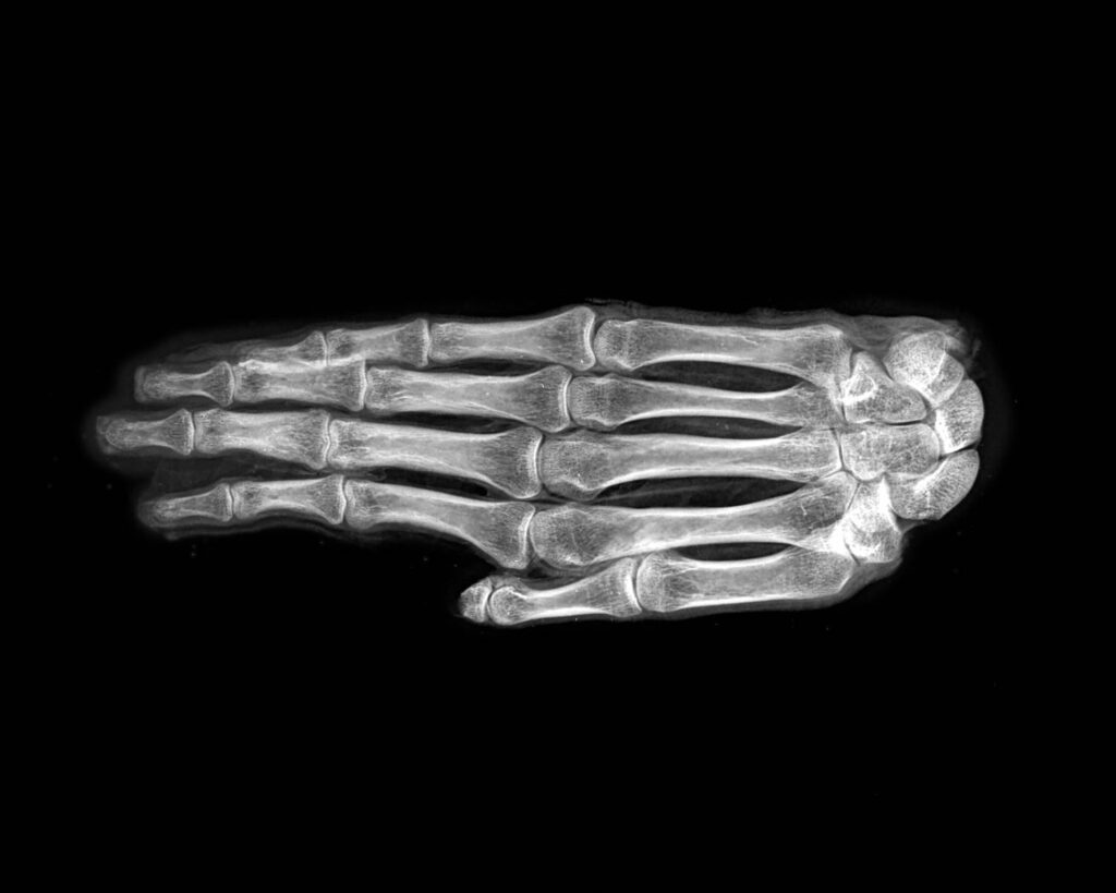 Egyptian mummified hand with X-Ray for sale | Egyptian Antiquities for sale
